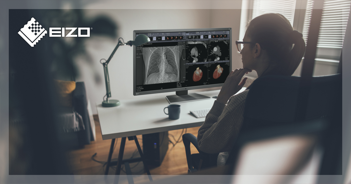 Monitor EIZO per la teleradiologia